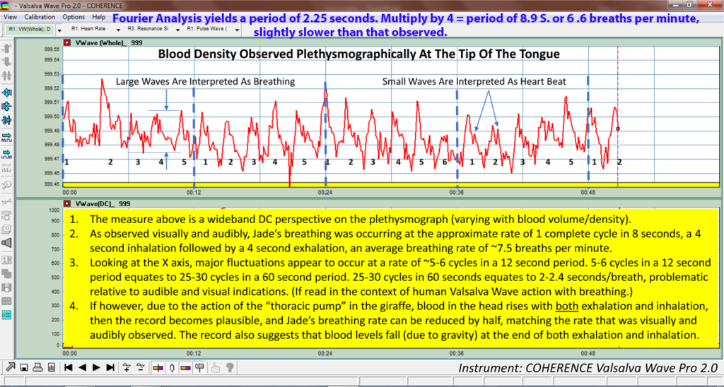 COHERENT BREATHING – Stephen Elliott, Founder, COHERENCE