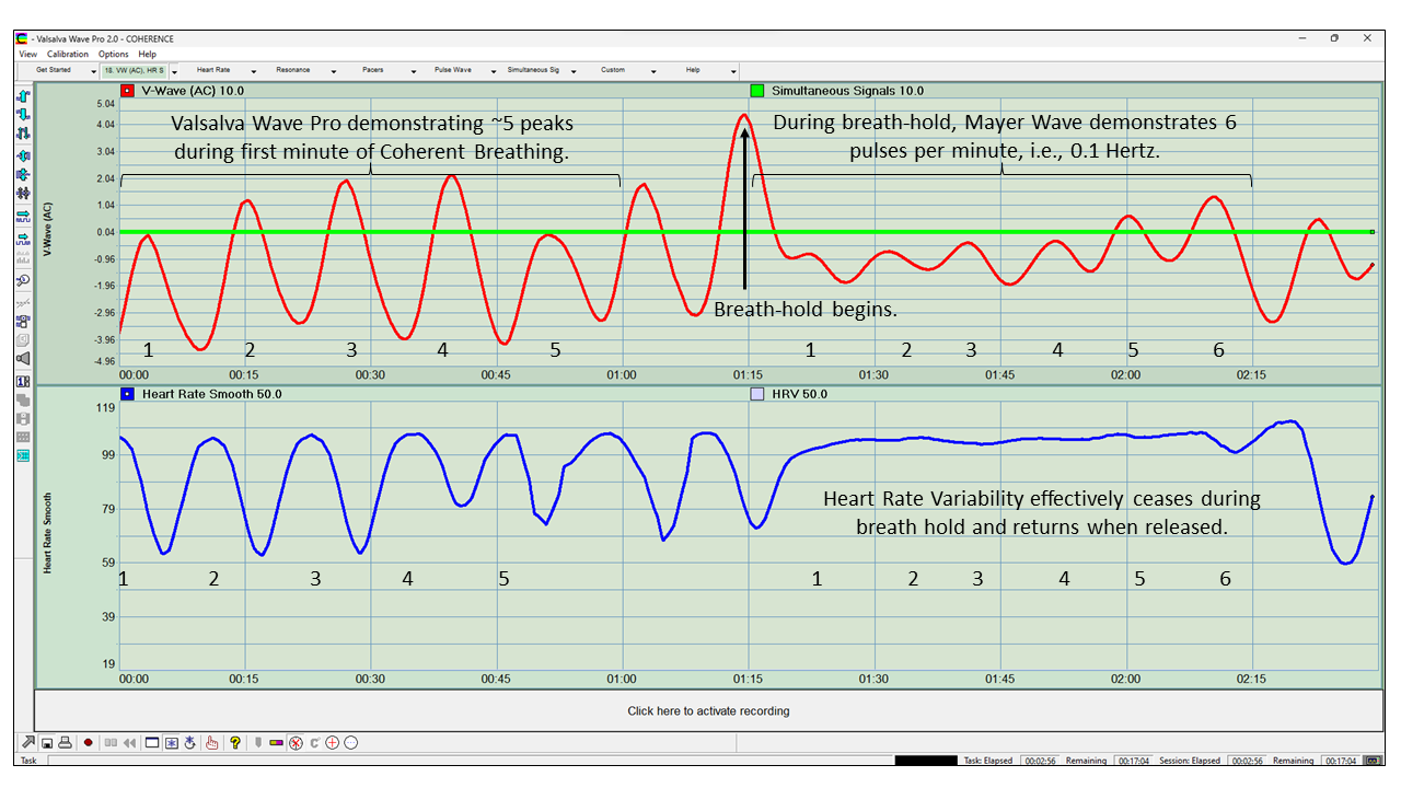 COHERENT BREATHING – Stephen Elliott, Founder, COHERENCE